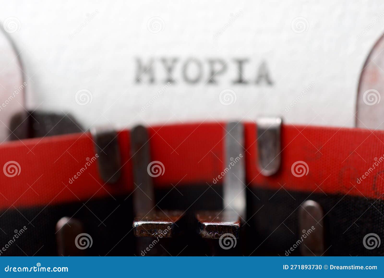 MYOPIA Word Made On Torn Paper, Medical Concept Background Royalty-Free ...