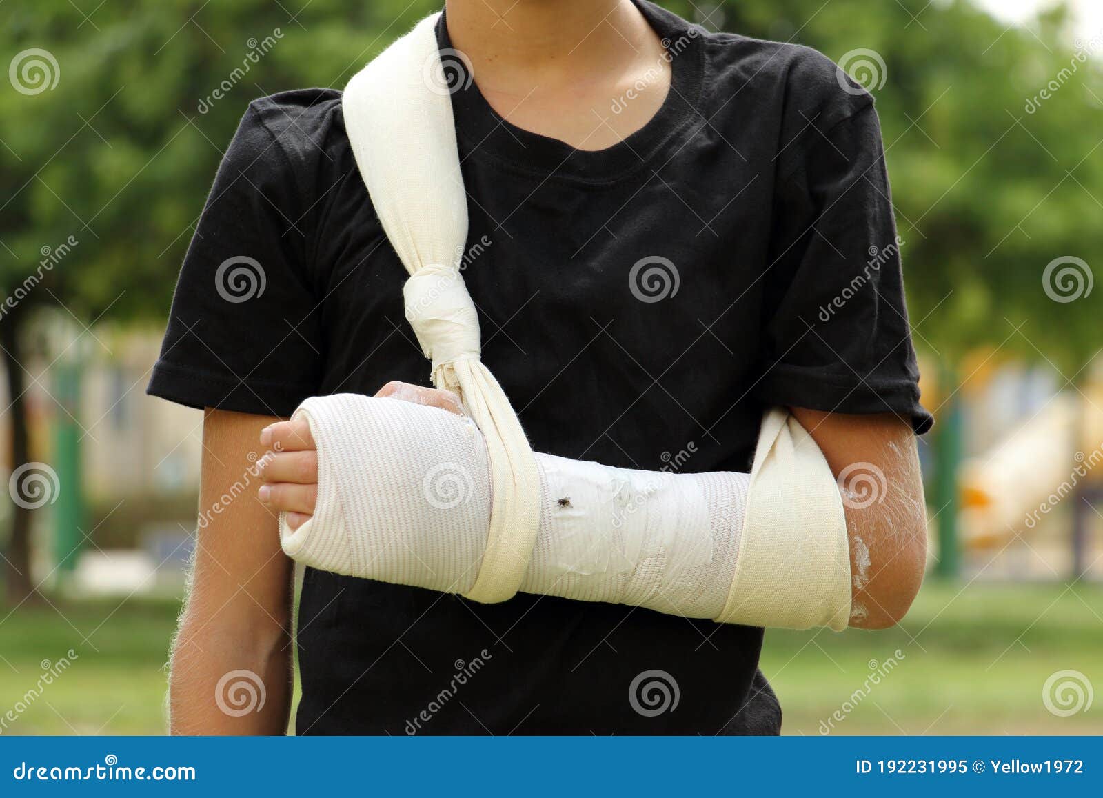 Naaste Jongen Met Gebroken Arm En Gips Stock Afbeelding - Image of pijn ...