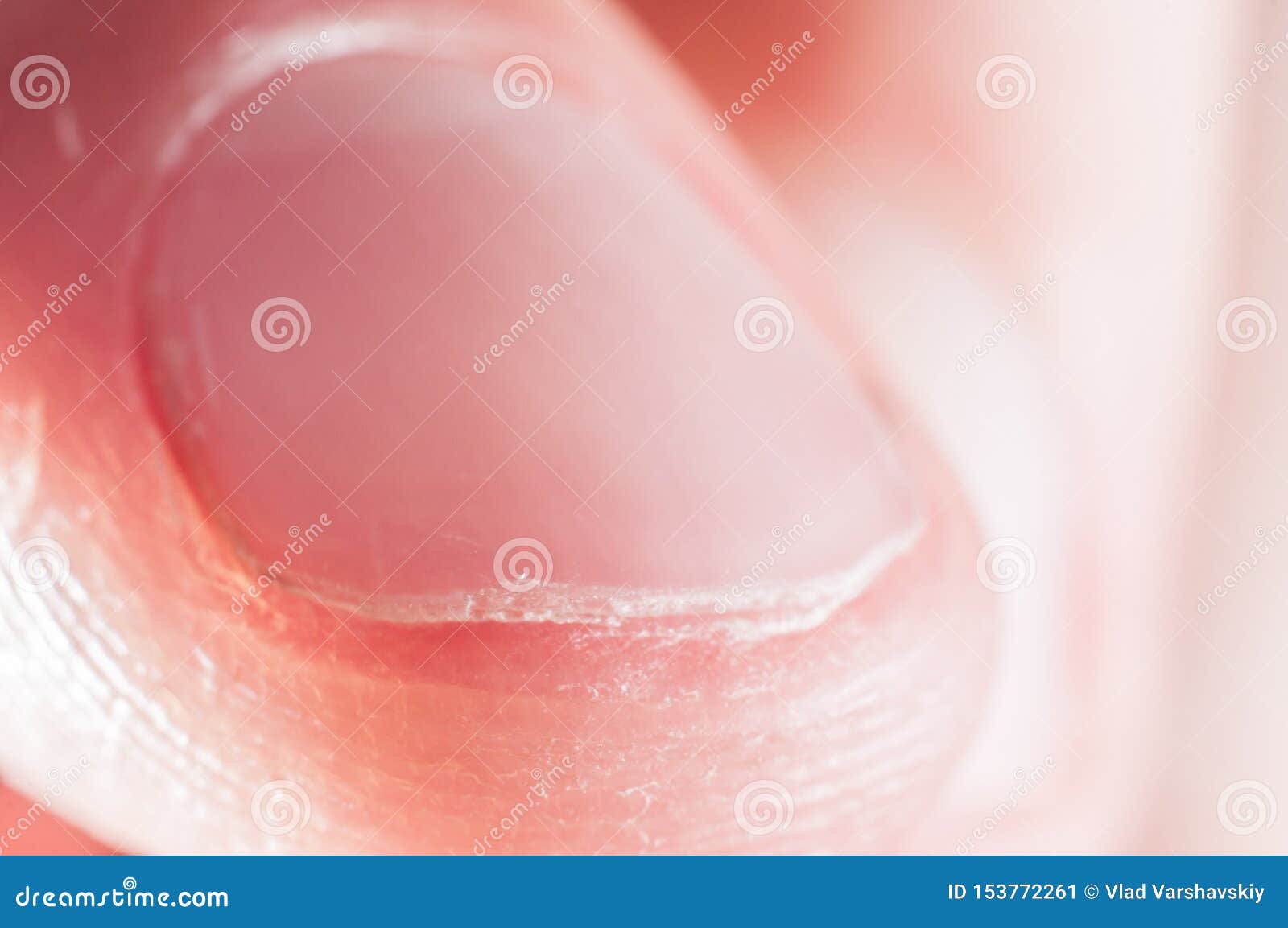 Nail on Human Finger Close Up, Macro Stock Image - Image of medicine ...