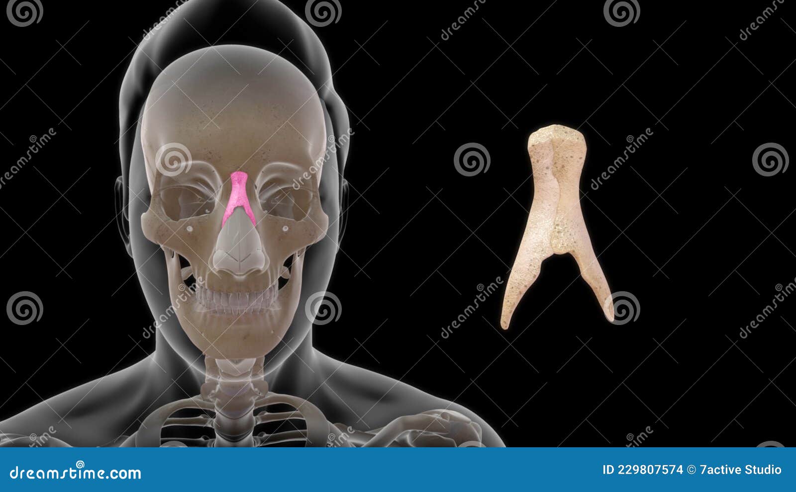 Nasal Bridge And Nose Bone Anatomy With Face Cartilage Outline Diagram ...
