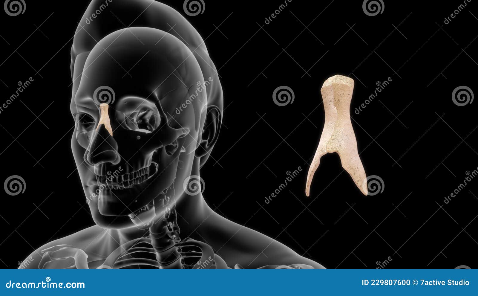 Nasal Bridge And Nose Bone Anatomy With Face Cartilage Outline Diagram ...