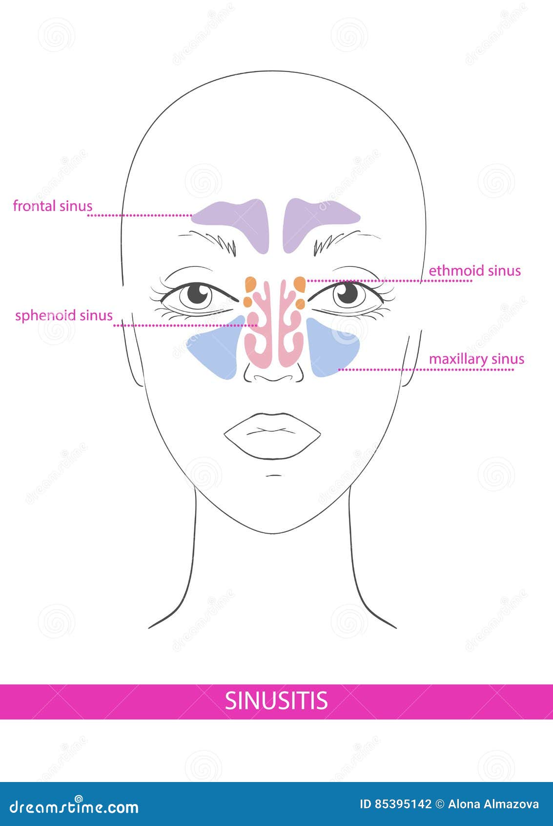 Nasal sinus. inflammation stock illustration. Illustration of nasal ...