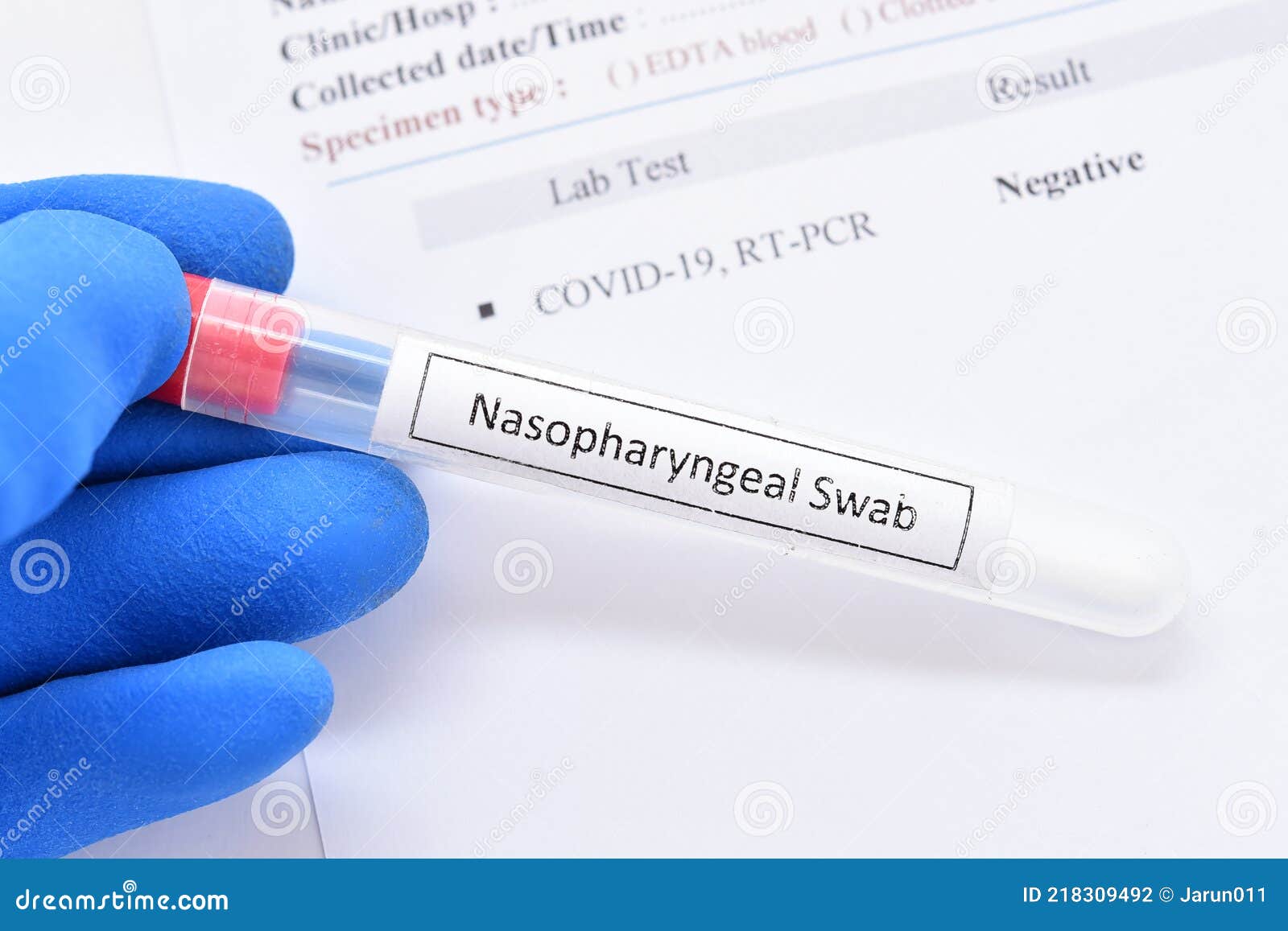 Nasopharyngeal Swab Negative with COVID-19 Stock Photo - Image of blood ...