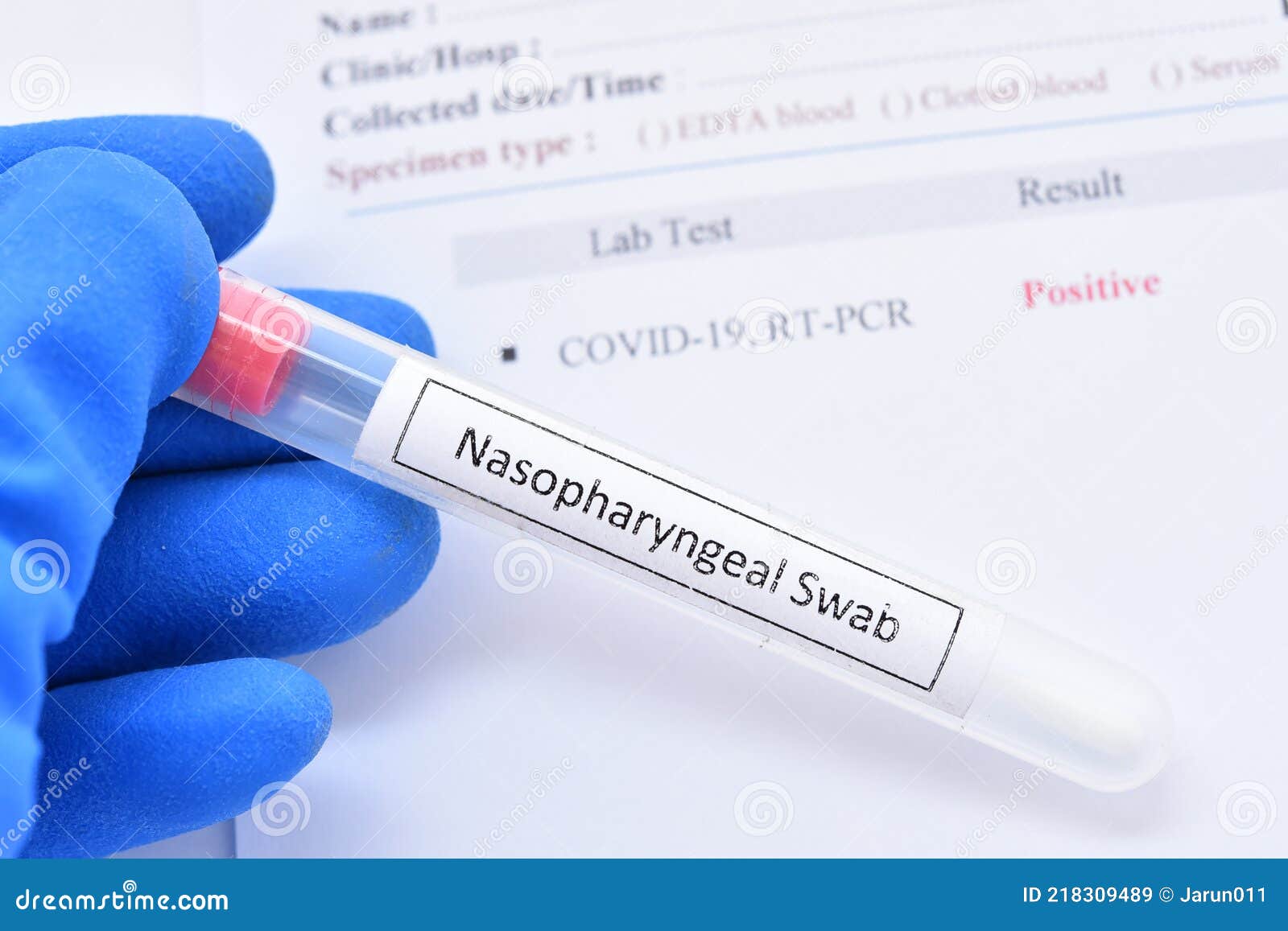 Nasopharyngeal Swab Positive with COVID-19 Stock Image - Image of ...