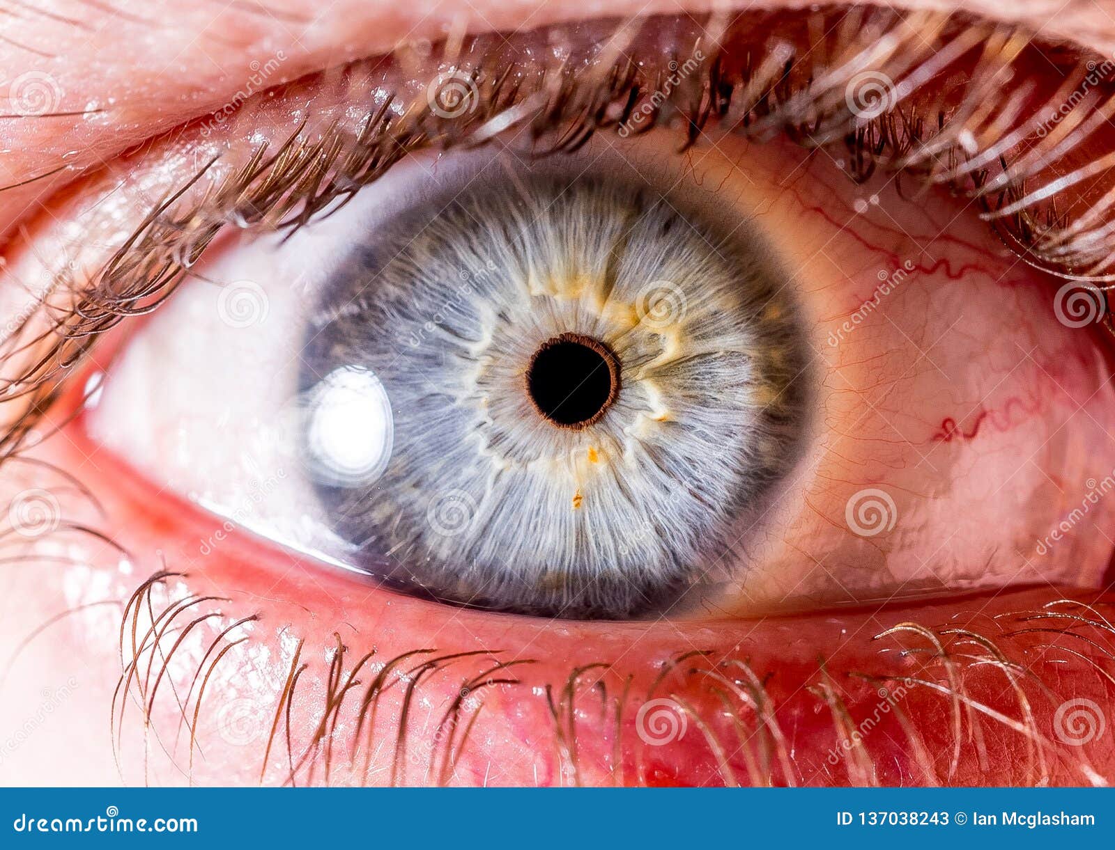 Close Up Eye. Close Up Iris. Very Close Macro Shot of an Eyeball Stock ...