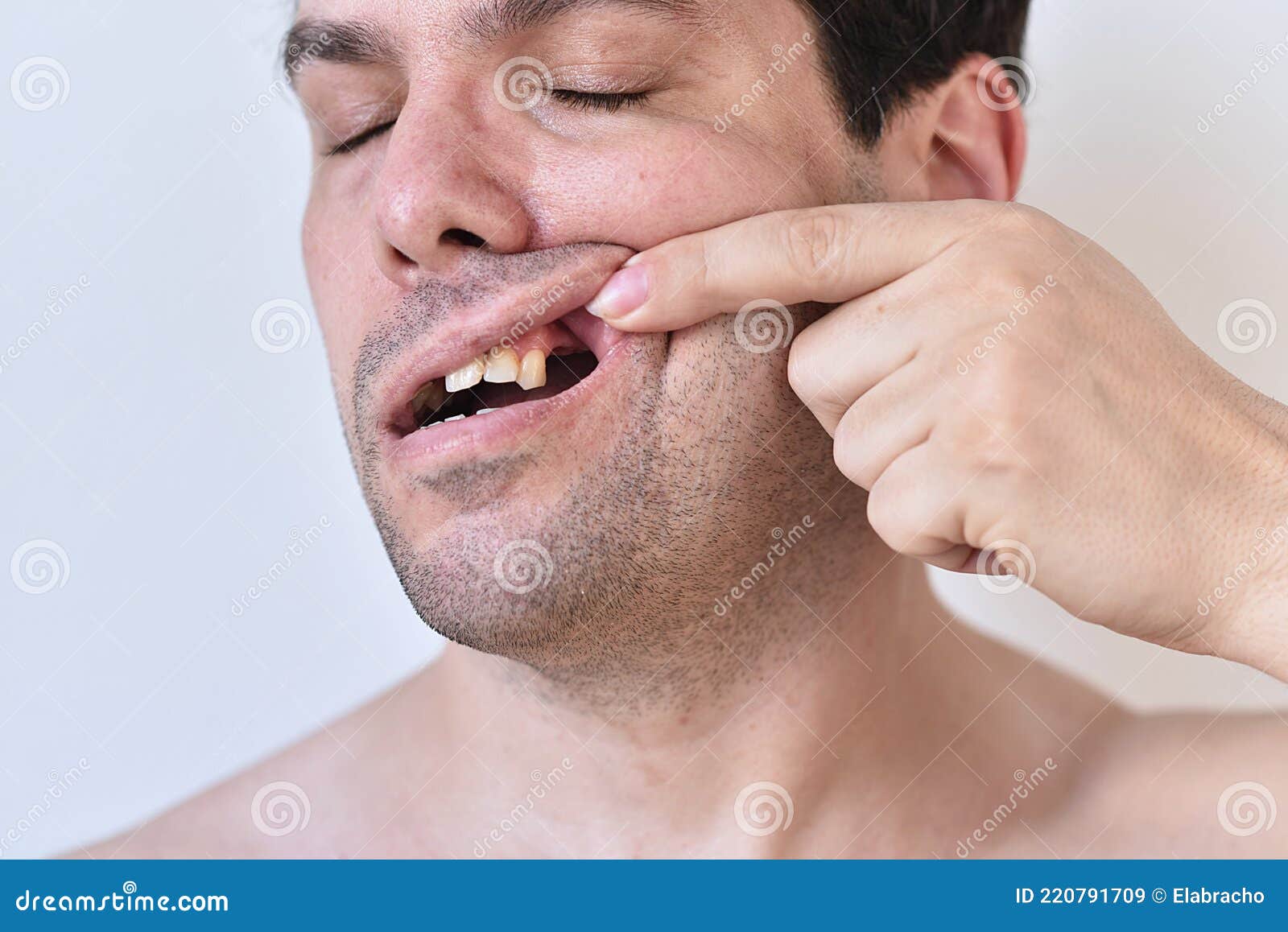 Portrait of a Man with Broken Teeth Stock Image - Image of male, person ...