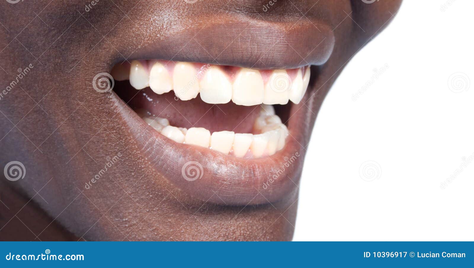 Natural teeth stock image. Image of american, mouth, natural - 10396917