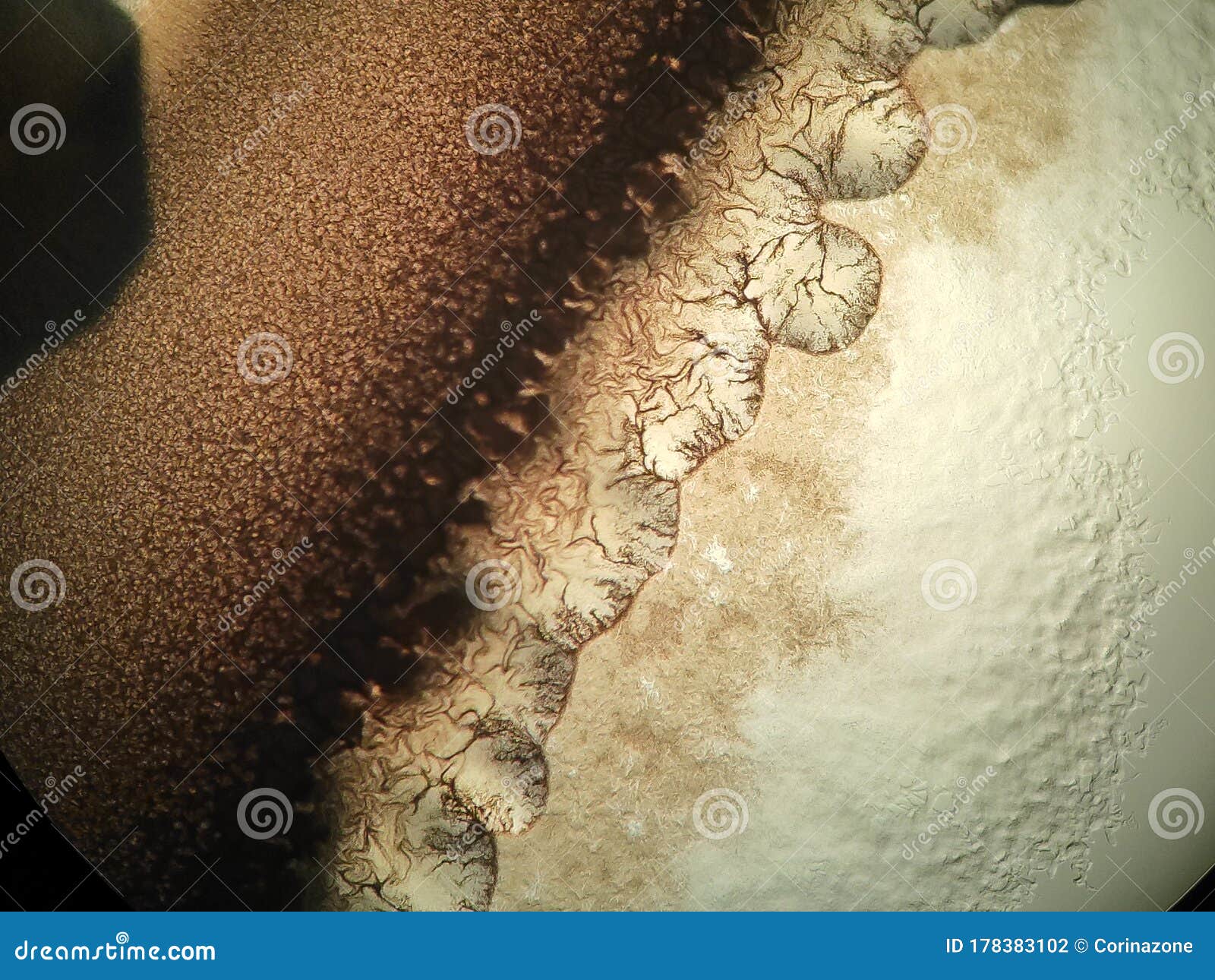 The Art of Bacteria Microscope View of Bacillus and Other Bacteria ...