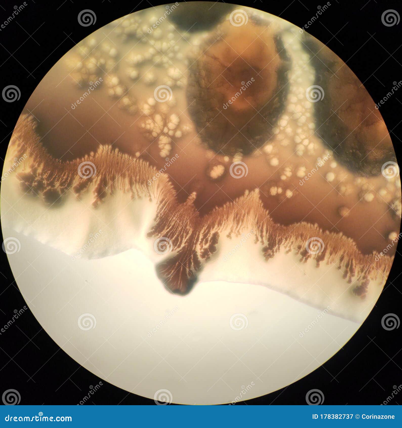 The Beautiful Art of Bacteria - Microscope View of Bacillus and Other ...