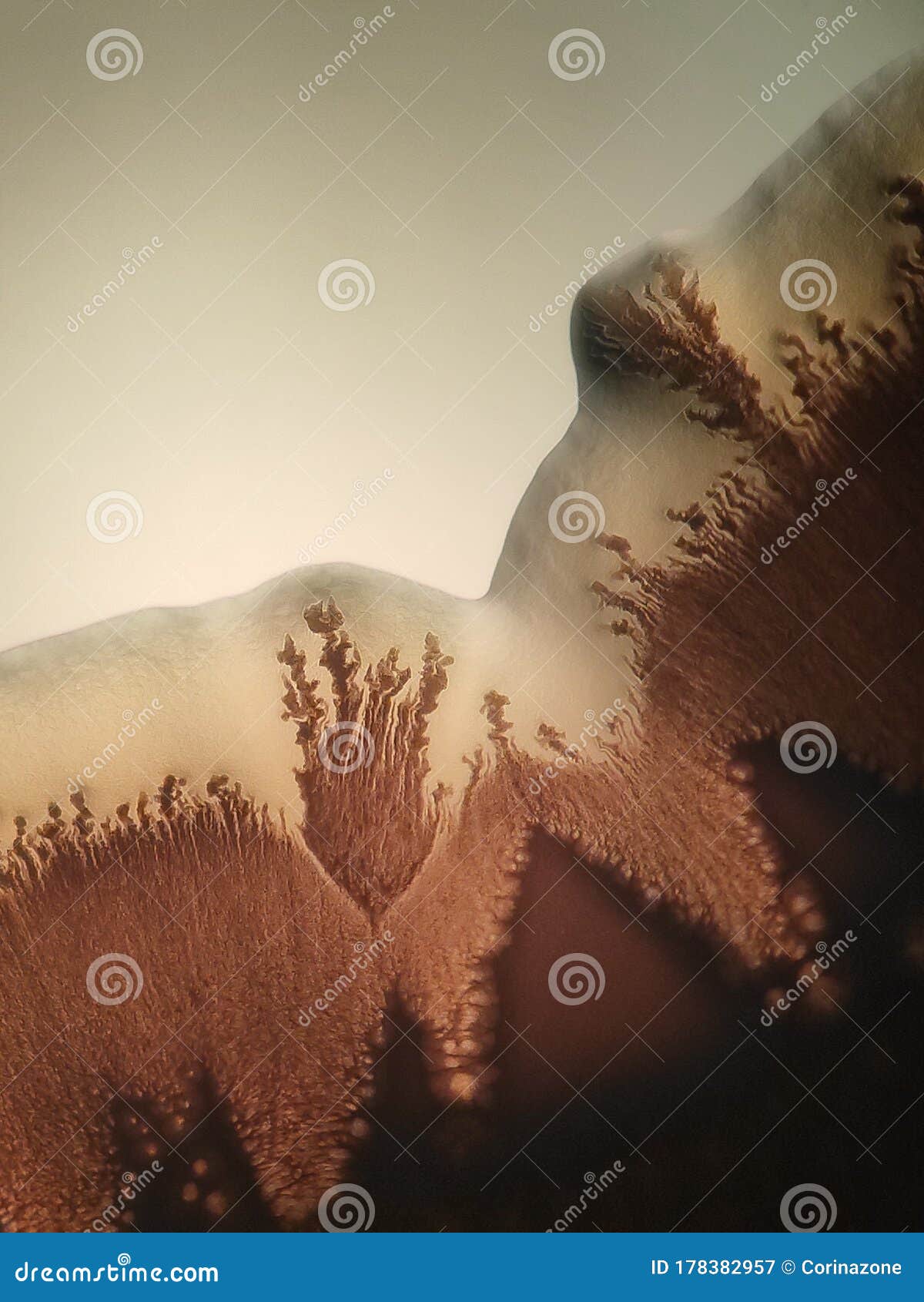 The Beautiful Art of Bacteria - Microscope View of Bacillus and Other ...