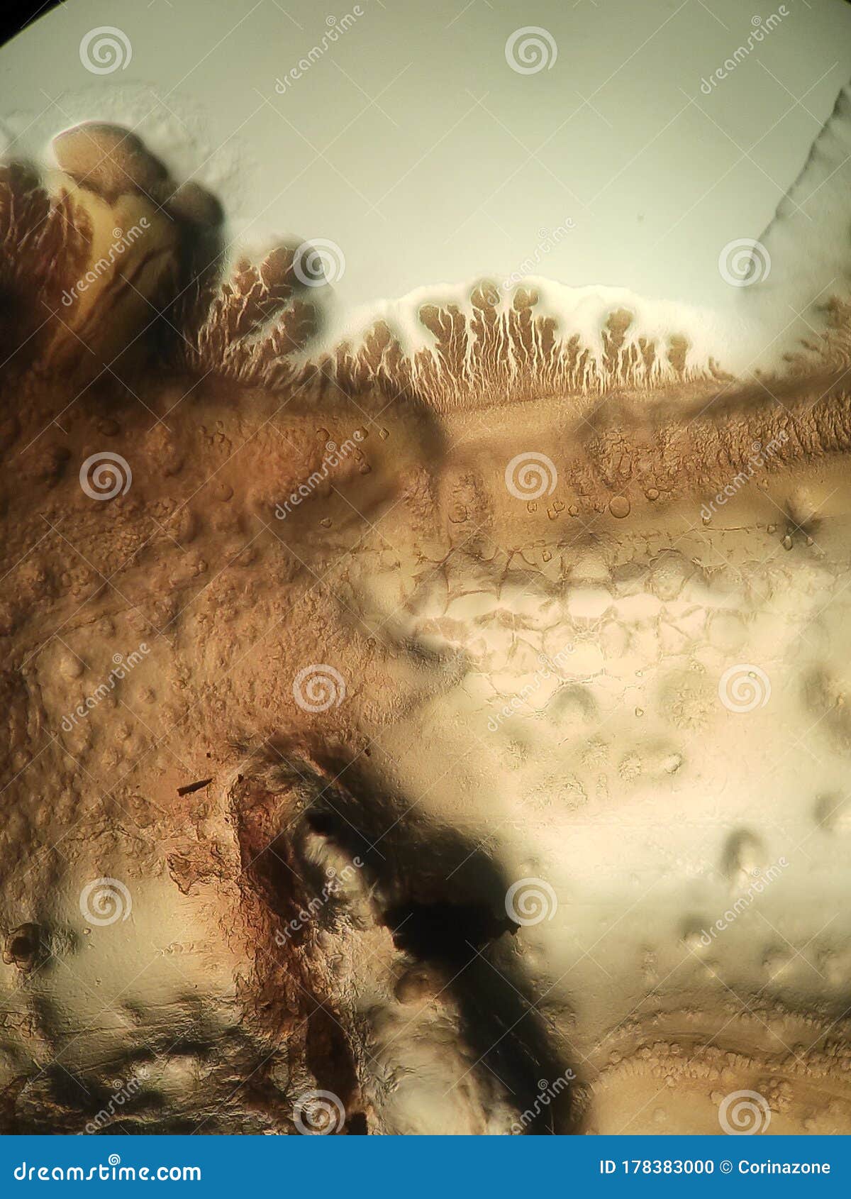 The Beautiful Art of Bacteria - Microscope View of Bacillus and Other ...