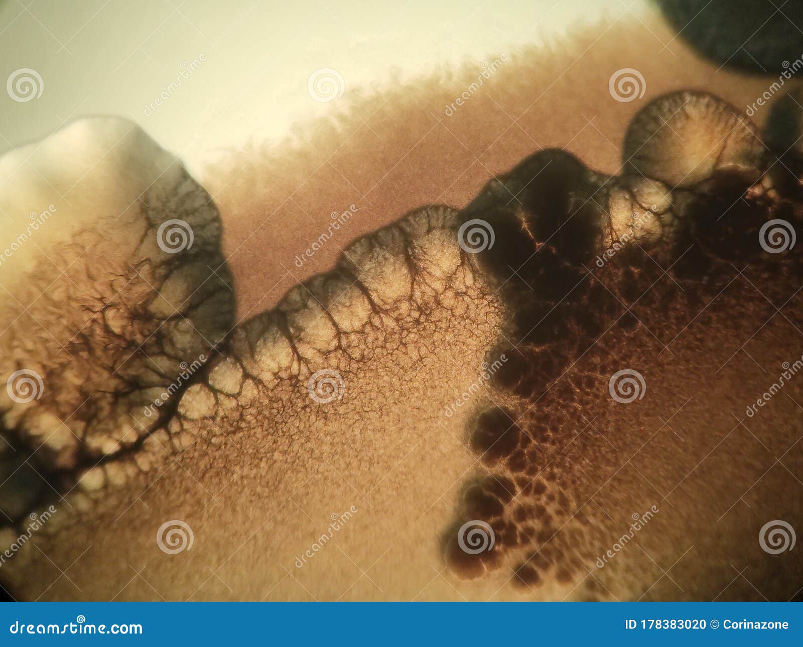The Beautiful Art of Bacteria - Microscope View of Bacillus and Other ...