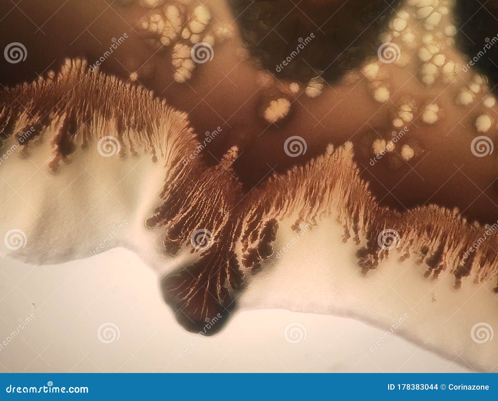 The Beautiful Art of Bacteria - Microscope View of Bacillus and Other ...
