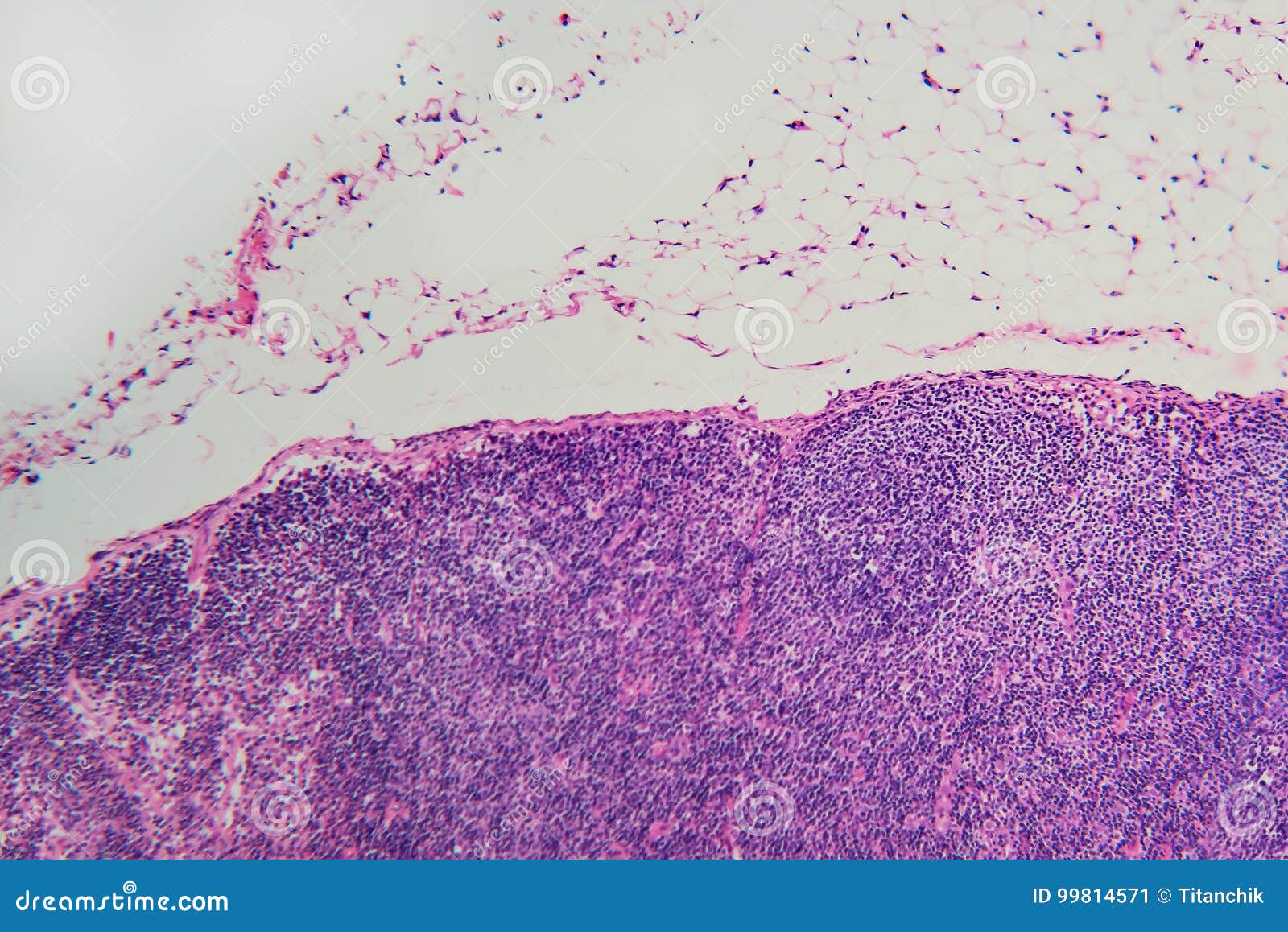 Lymph Node Microscope Slide