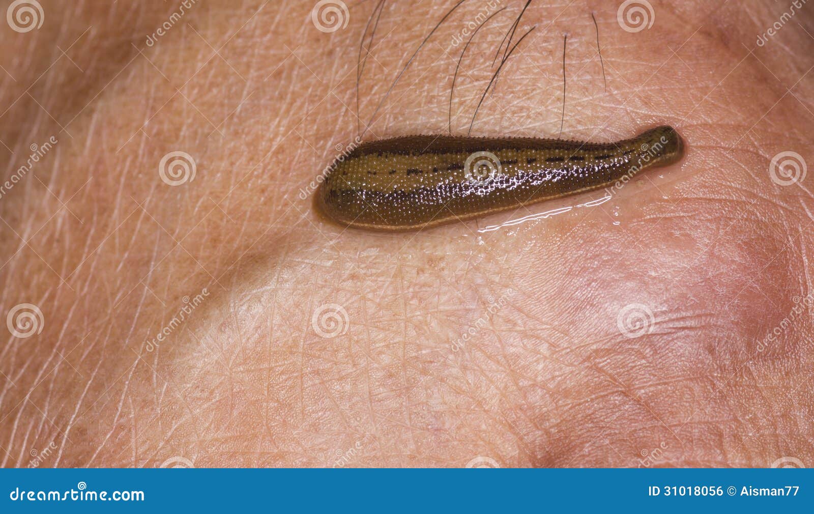Nature leech stock photo. Image of biology, macro, detail - 31018056
