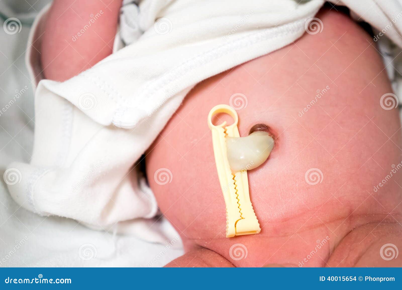 Navelstreng Van Pasgeboren Baby Stock Foto - Image of horizontaal ...
