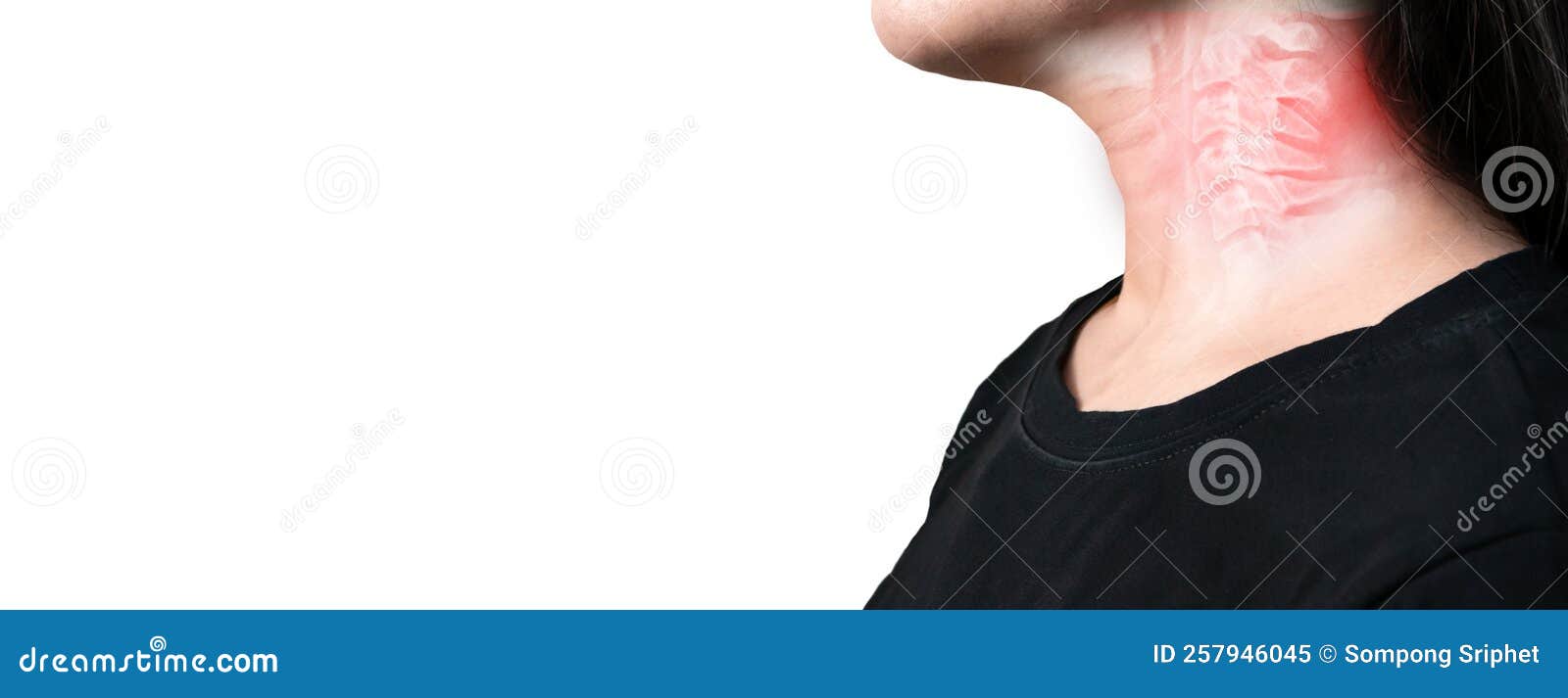 Neck Bone Cervical Spondylosis Inflammation the Cervical Spine Stock ...