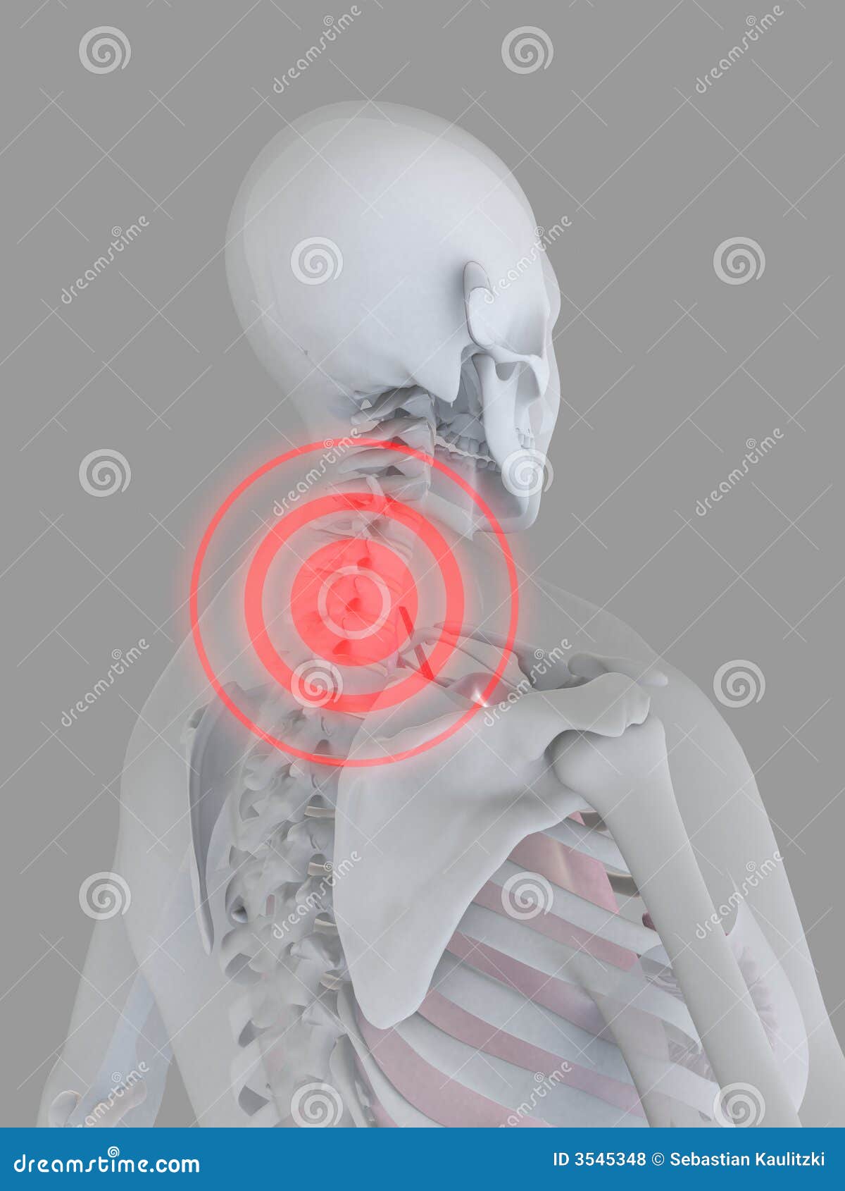 Neck inflammation stock illustration. Illustration of ache - 3545348
