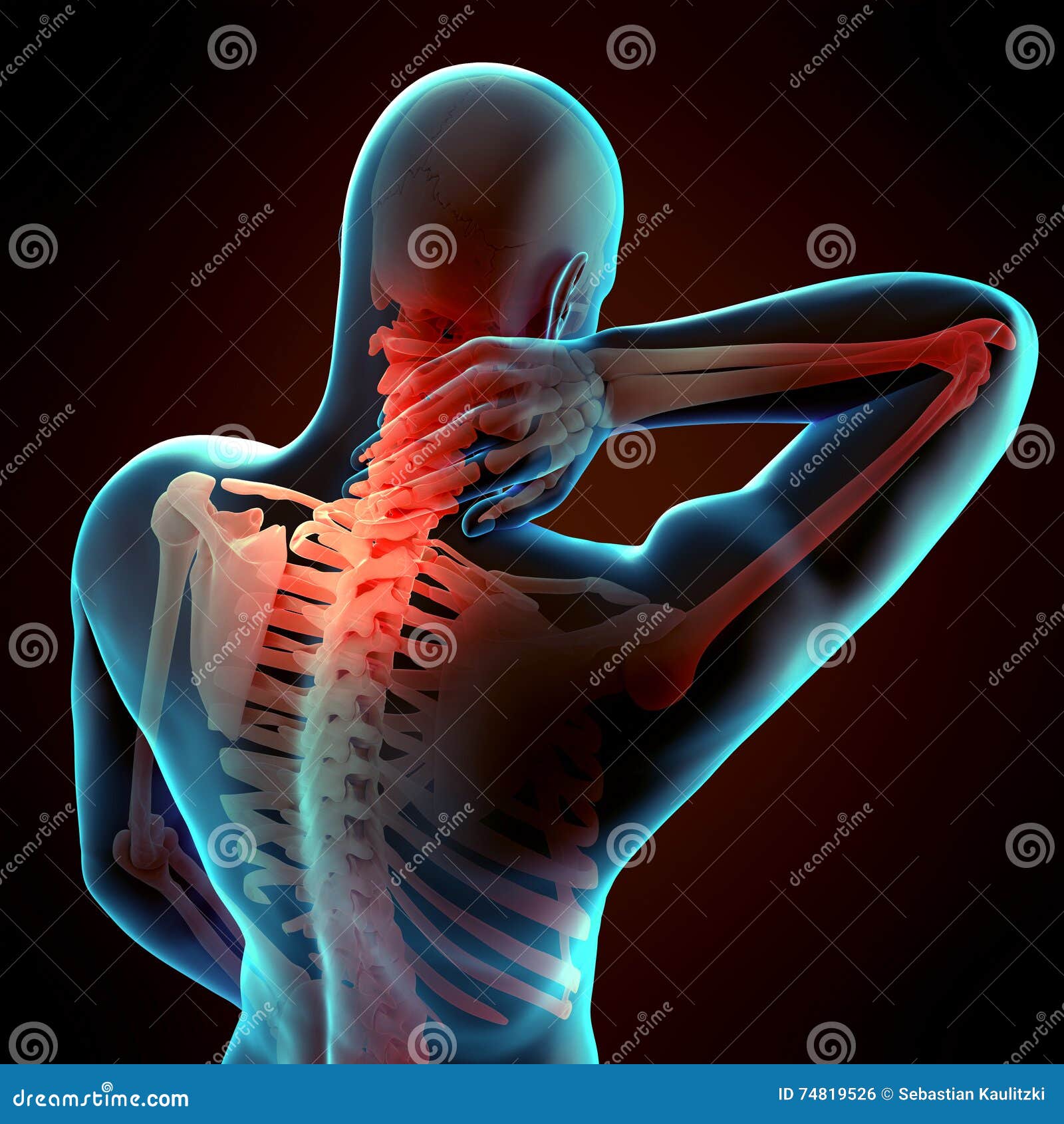 Neck Pain Stock Illustrations – 2,851 Neck Pain Stock Illustrations ...