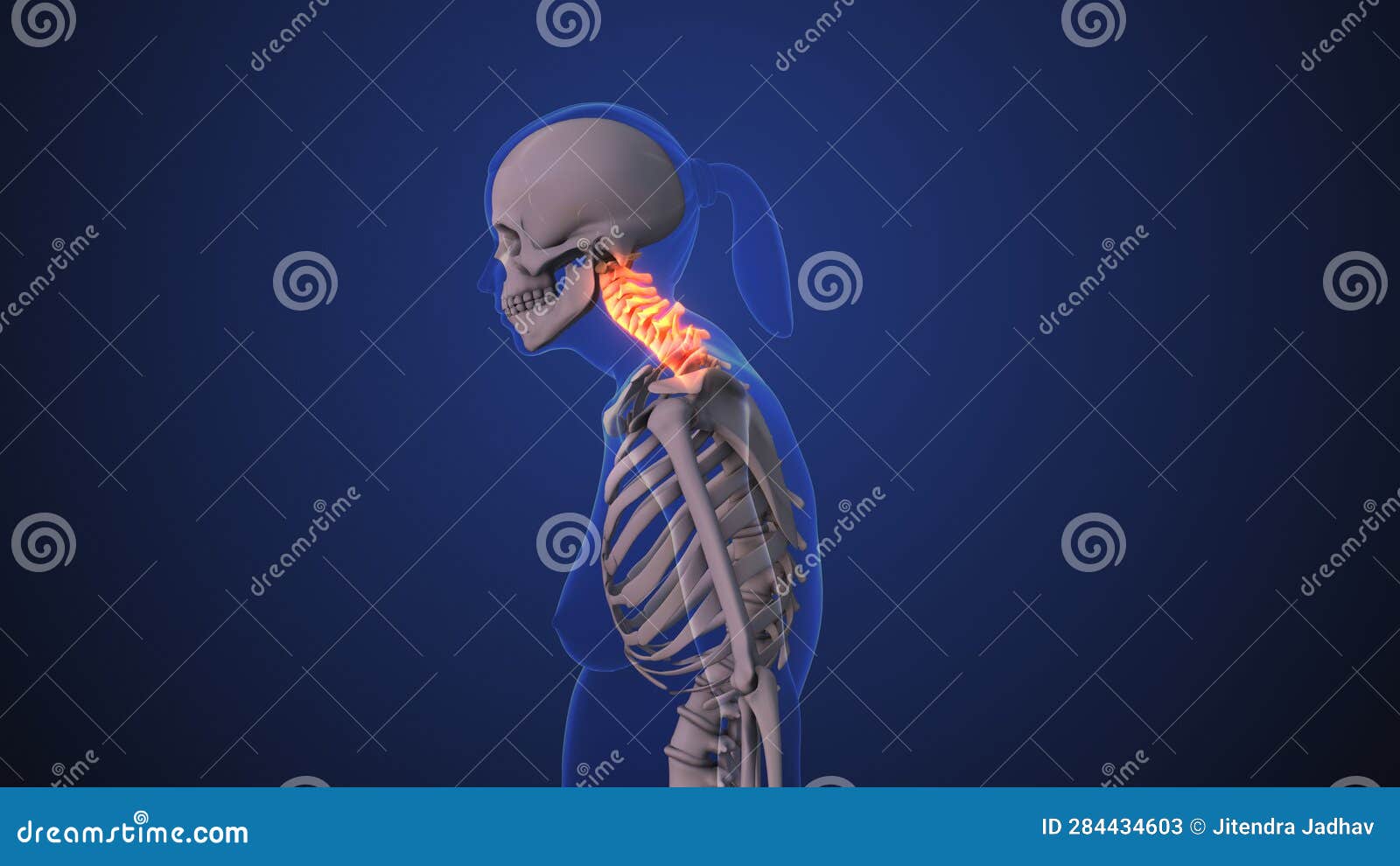 Neck Pain or Neck Dysfunction or Cervical Posture Syndrome Stock ...