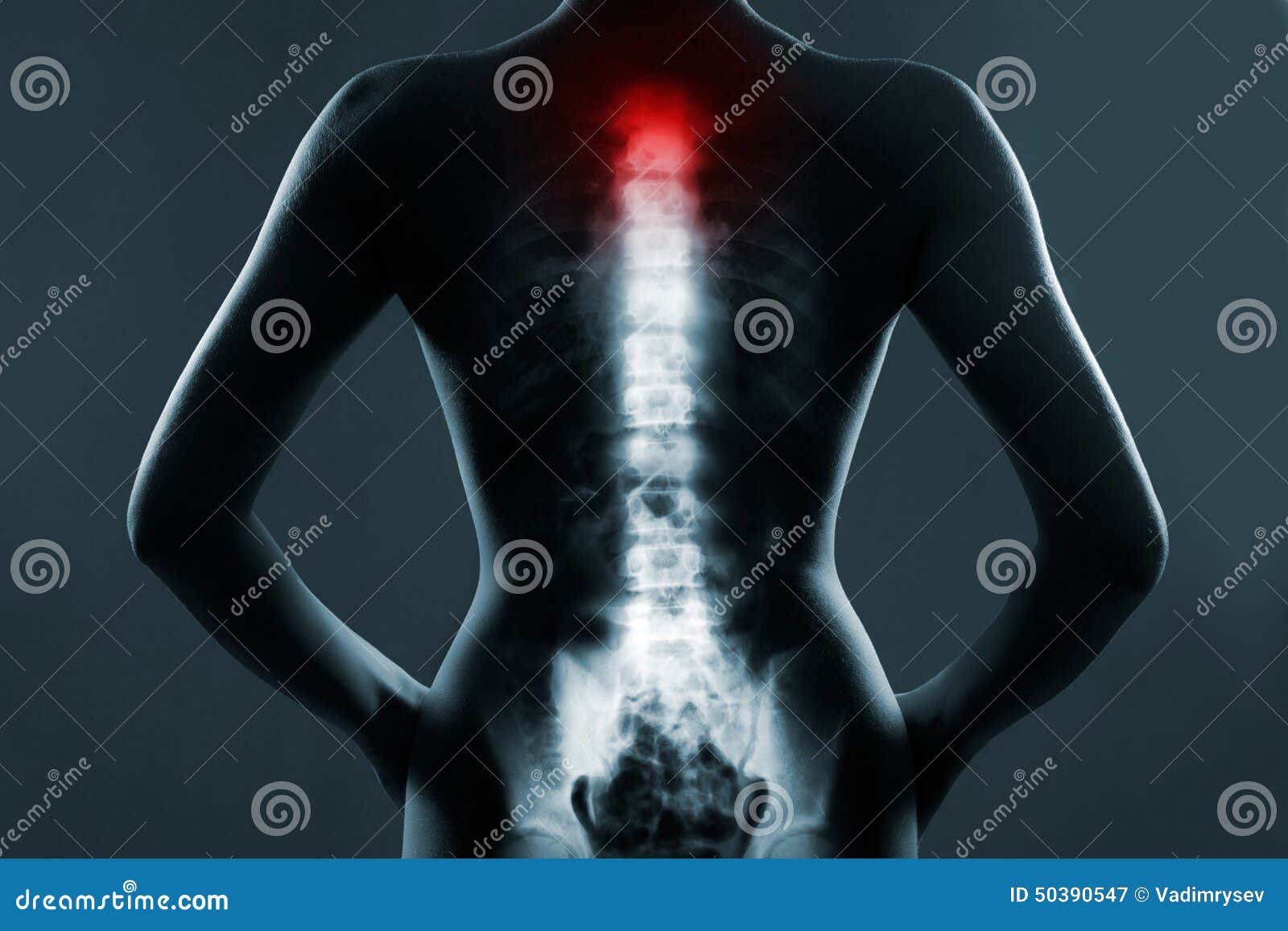 The Neck Spine is Highlighted by Red Colour Stock Image - Image of ...