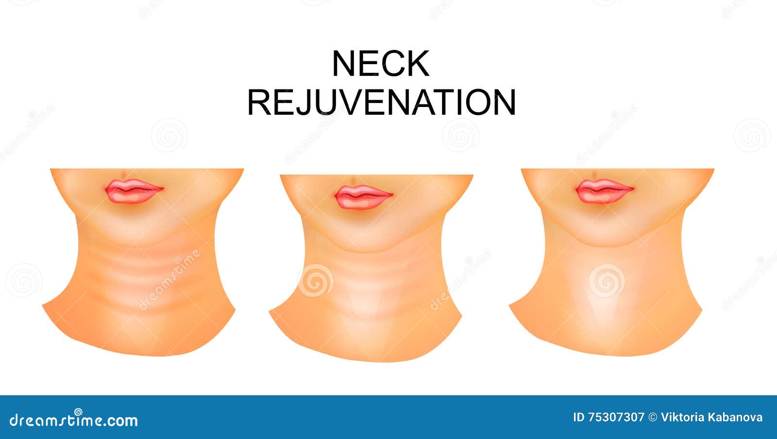 Neck, Wrinkles, Rejuvenation Stock Vector - Illustration of aging ...