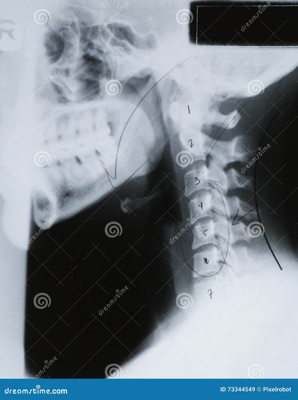 Neck Xray stock image. Image of exam, physiology, anatomy - 73344549