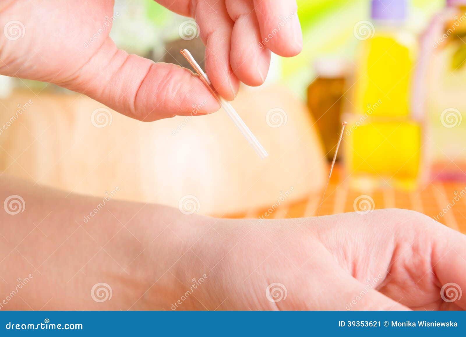 Needeling Acupuncture stock image. Image of medicine - 39353621