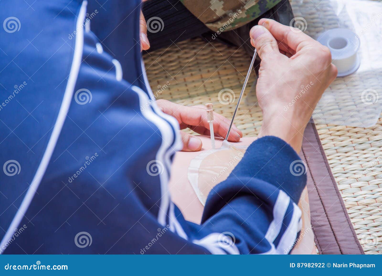 Needle Stab Thoracic in Case Pneumothorax Stock Photo - Image of ...