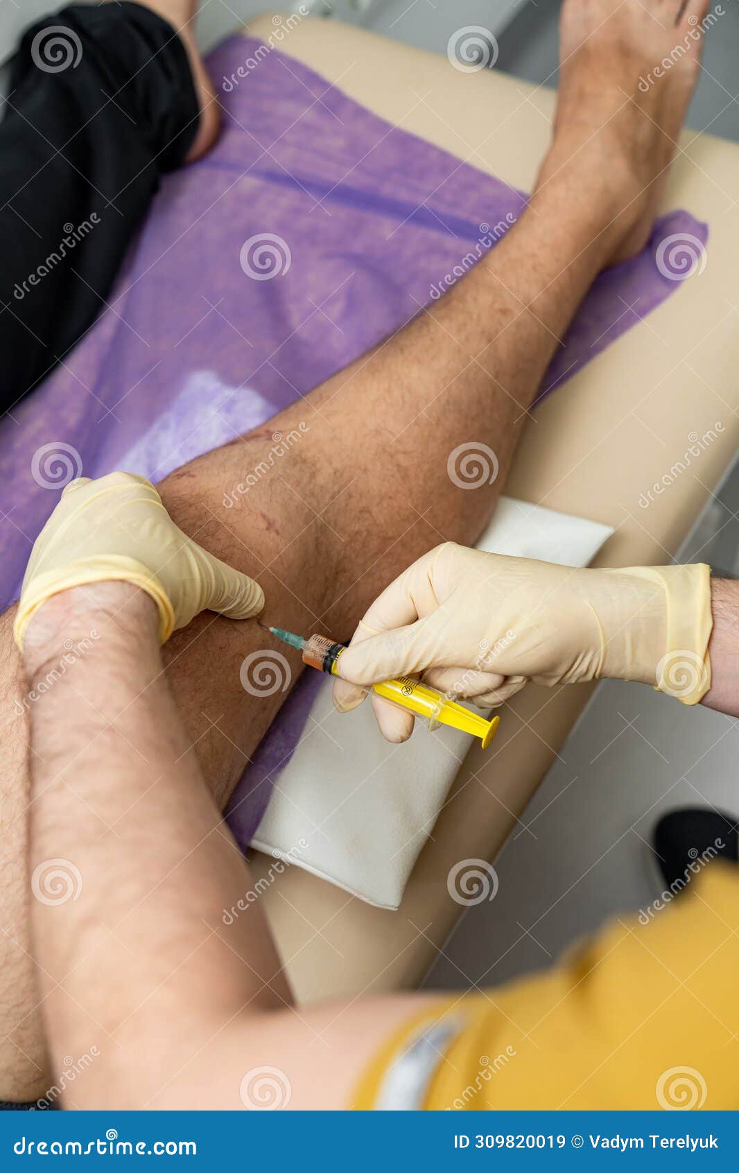 Needle Therapy Injection. Platelet Rich Plasma Collecting Stock Image ...