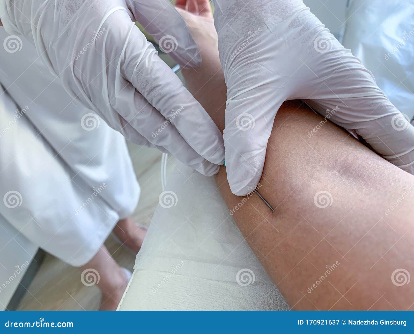 A Needle in the Vein, IV Fluids Stock Image - Image of donation ...