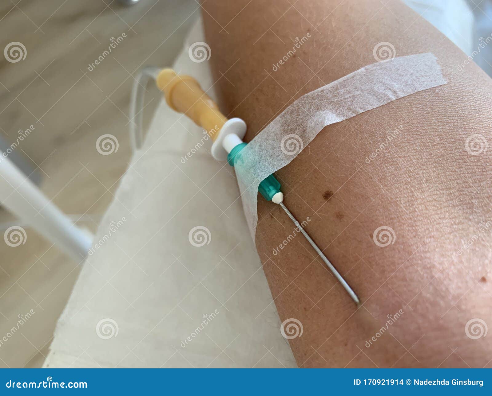 A Needle in the Vein, IV Fluids Stock Photo - Image of donation ...