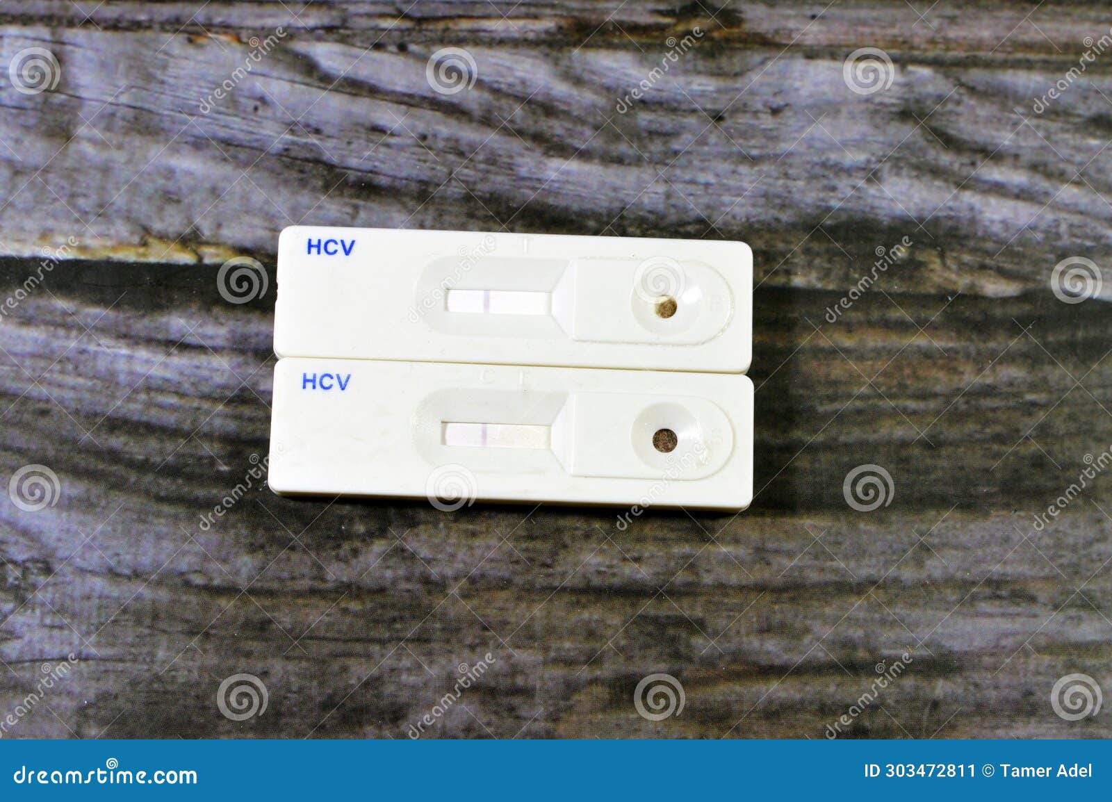 Negative Test Result of HCV Blood Sample Rapid Screening Test ...