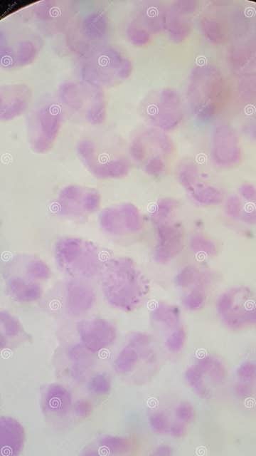 Neisseria Gonorrhea Intracellular Gram Negative Diplococci Stock
