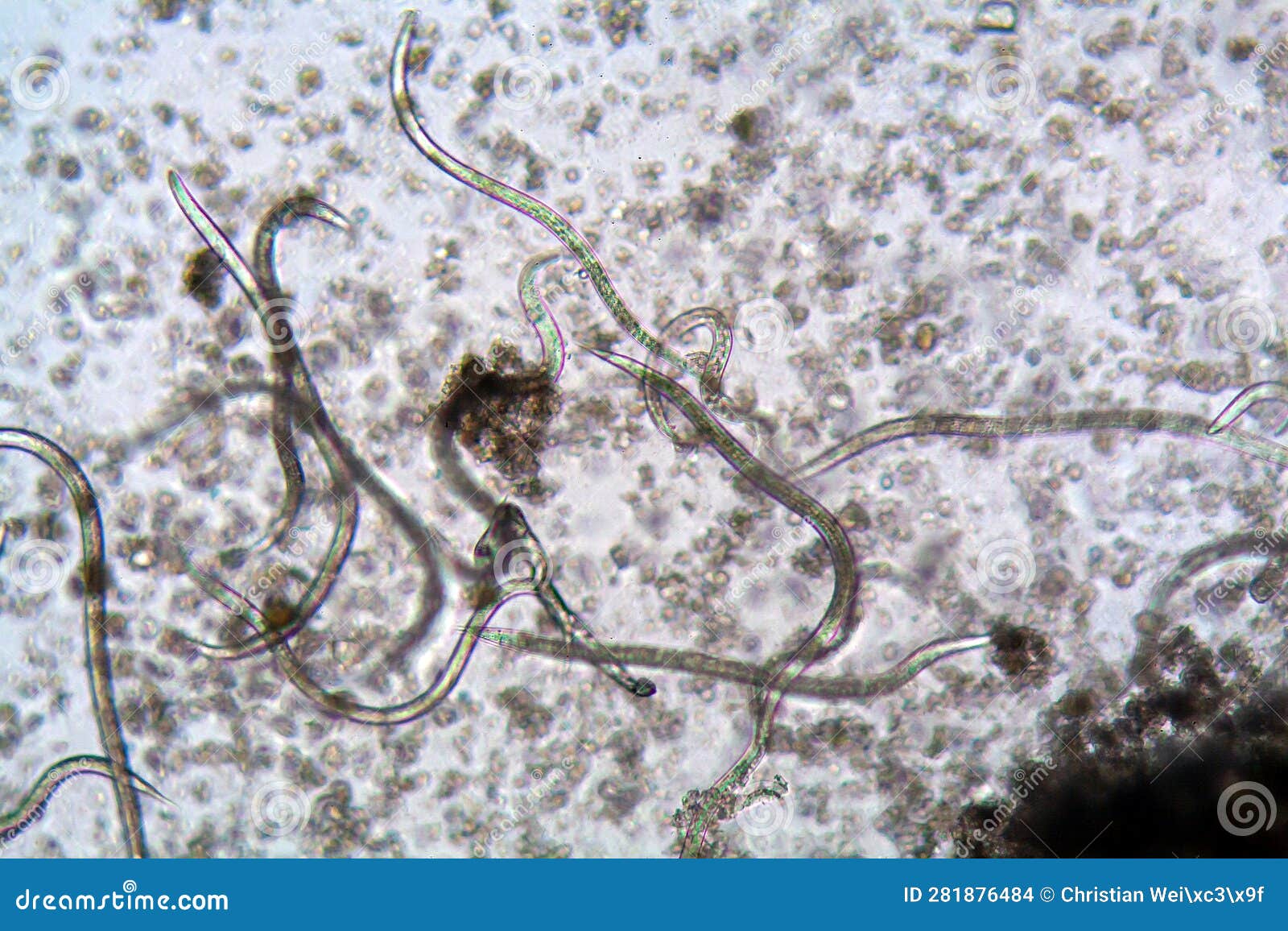 The Nematode Steinernema Feltiae Under the Microscope Stock Photo ...