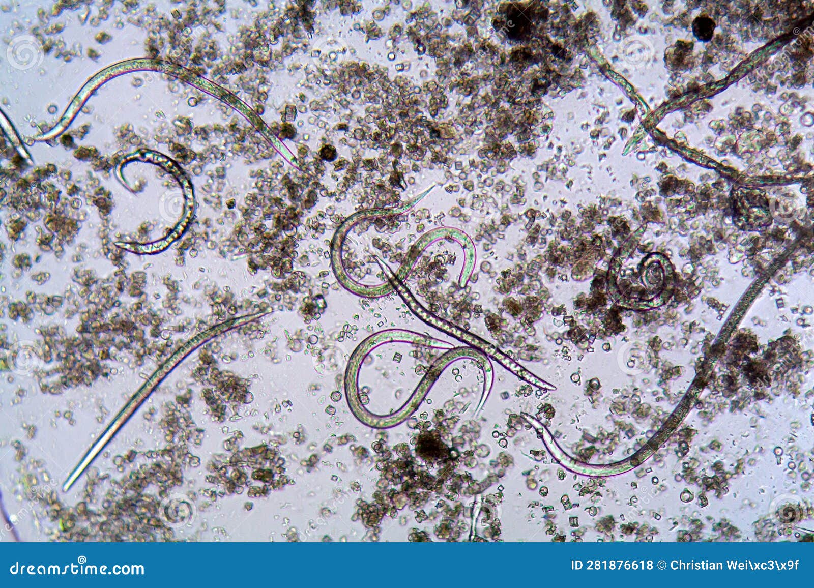 The Nematode Steinernema Feltiae Under the Microscope Stock Photo ...
