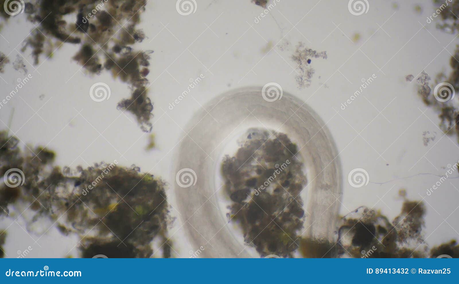 Nematode Under the Microscope in 4k Stock Footage - Video of disease ...