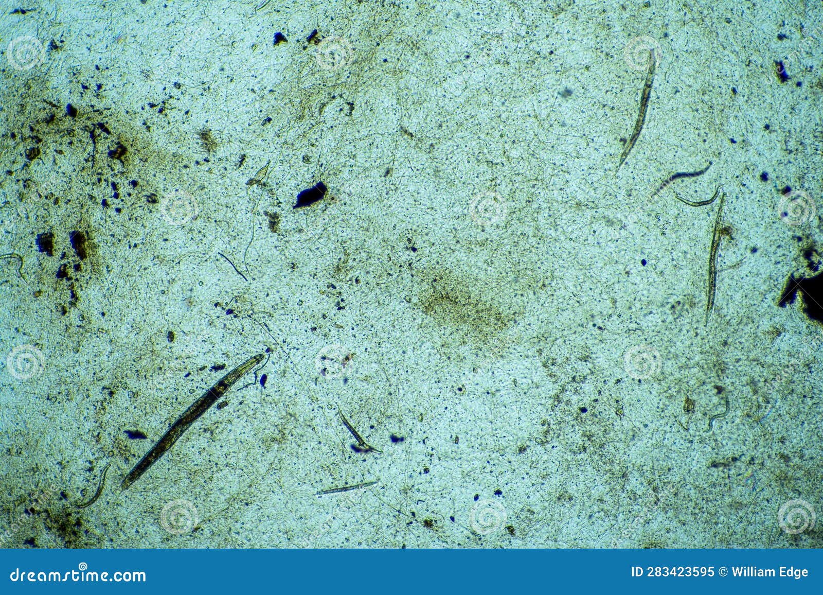 Nematode Under the Microscope Stock Image - Image of drawn, australia ...