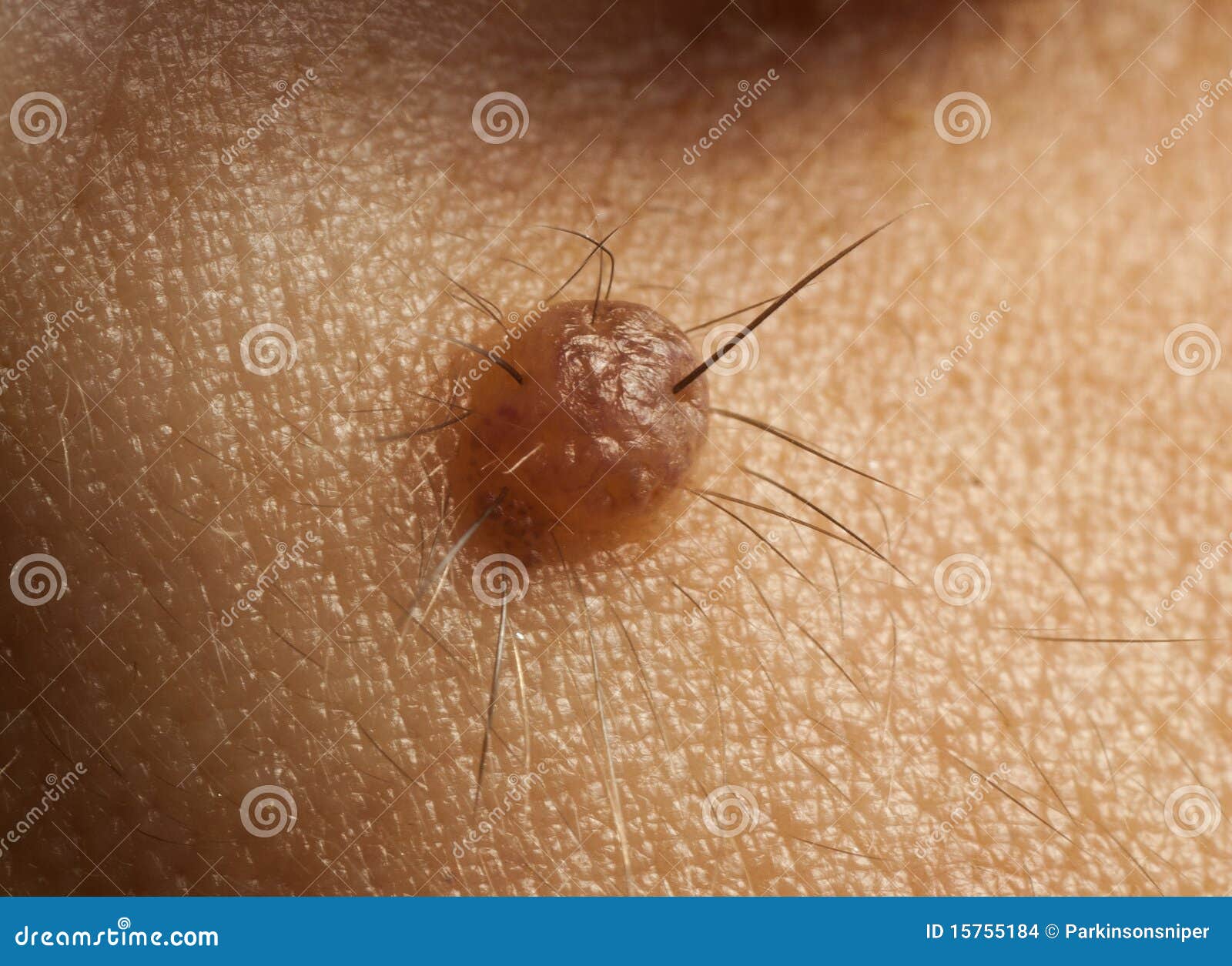 Neo con capelli fotografia stock. Immagine di umano, cellule - 15755184