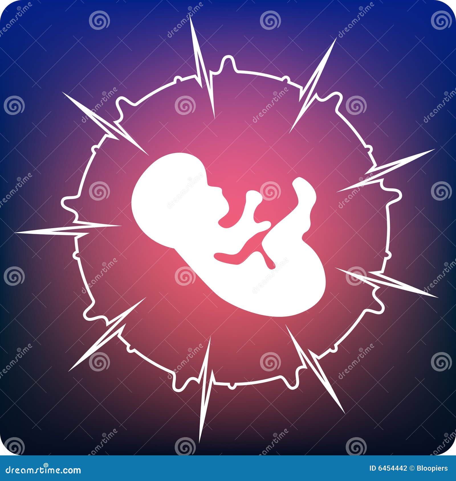 Neonatal resuscitation stock vector. Illustration of human - 6454442