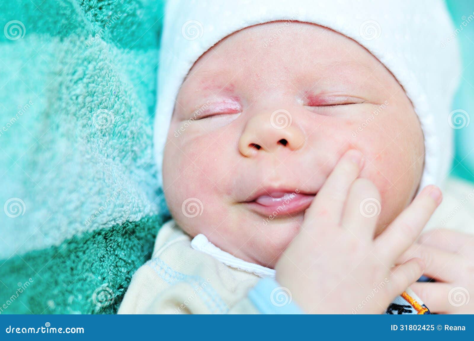 Neonatorum del acné imagen de archivo. Imagen de nacimiento - 31802425