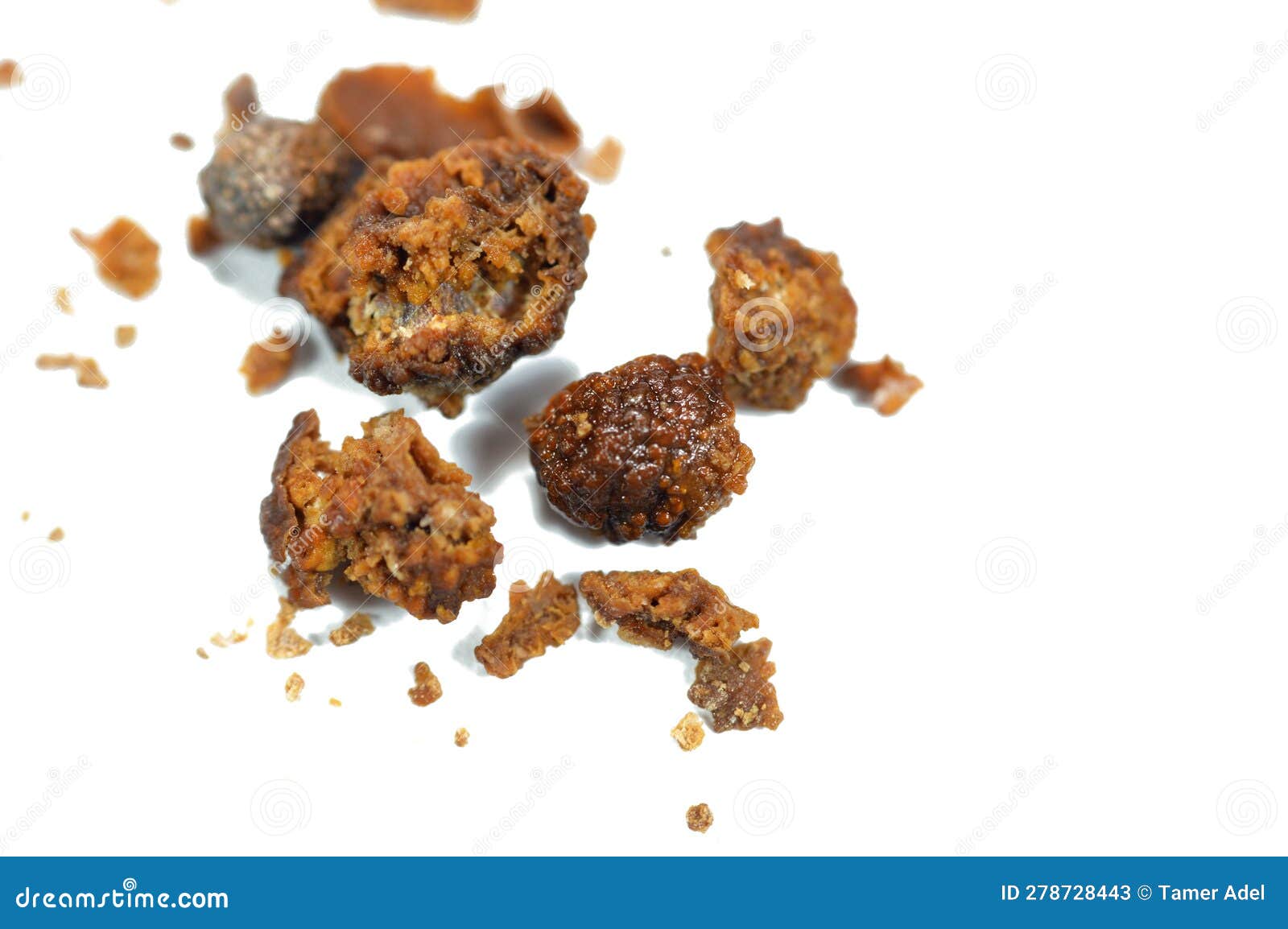 Nephrolithiasis, Irregular Brown Kidney Stones (renal Calculus or ...