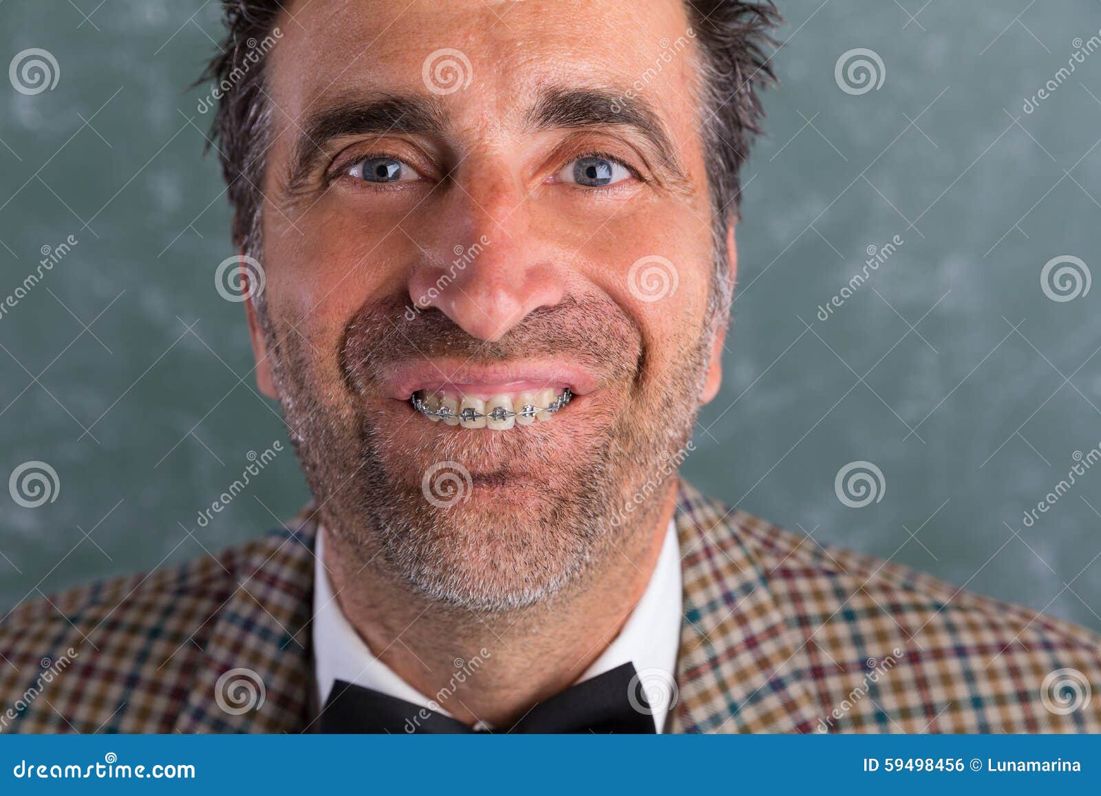 Nerd Silly Retro Man with Braces Funny Expression Stock Photo - Image ...