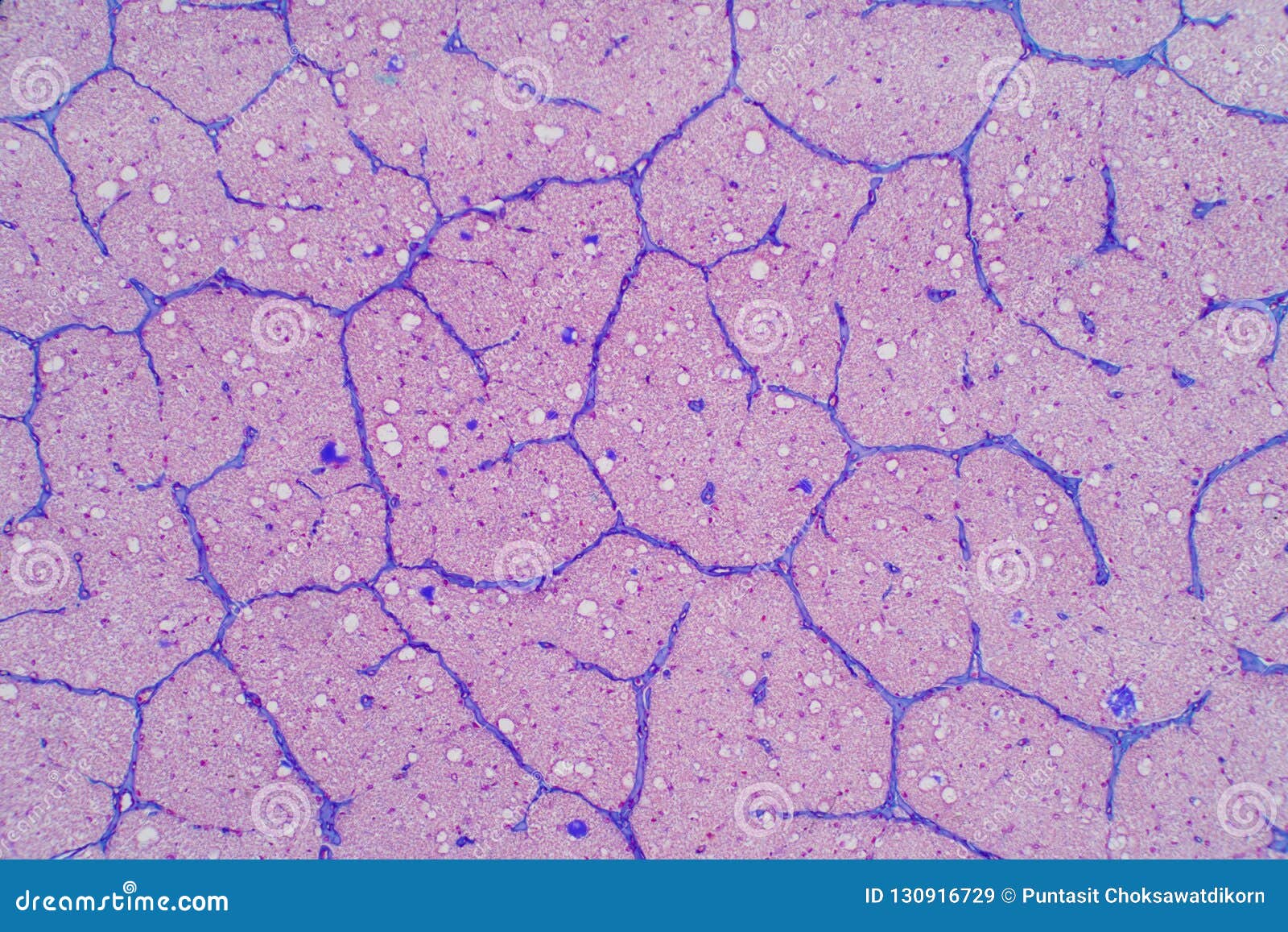 Nerf D'oeil Humain Sous La Vue De Microscope Image stock - Image du ...