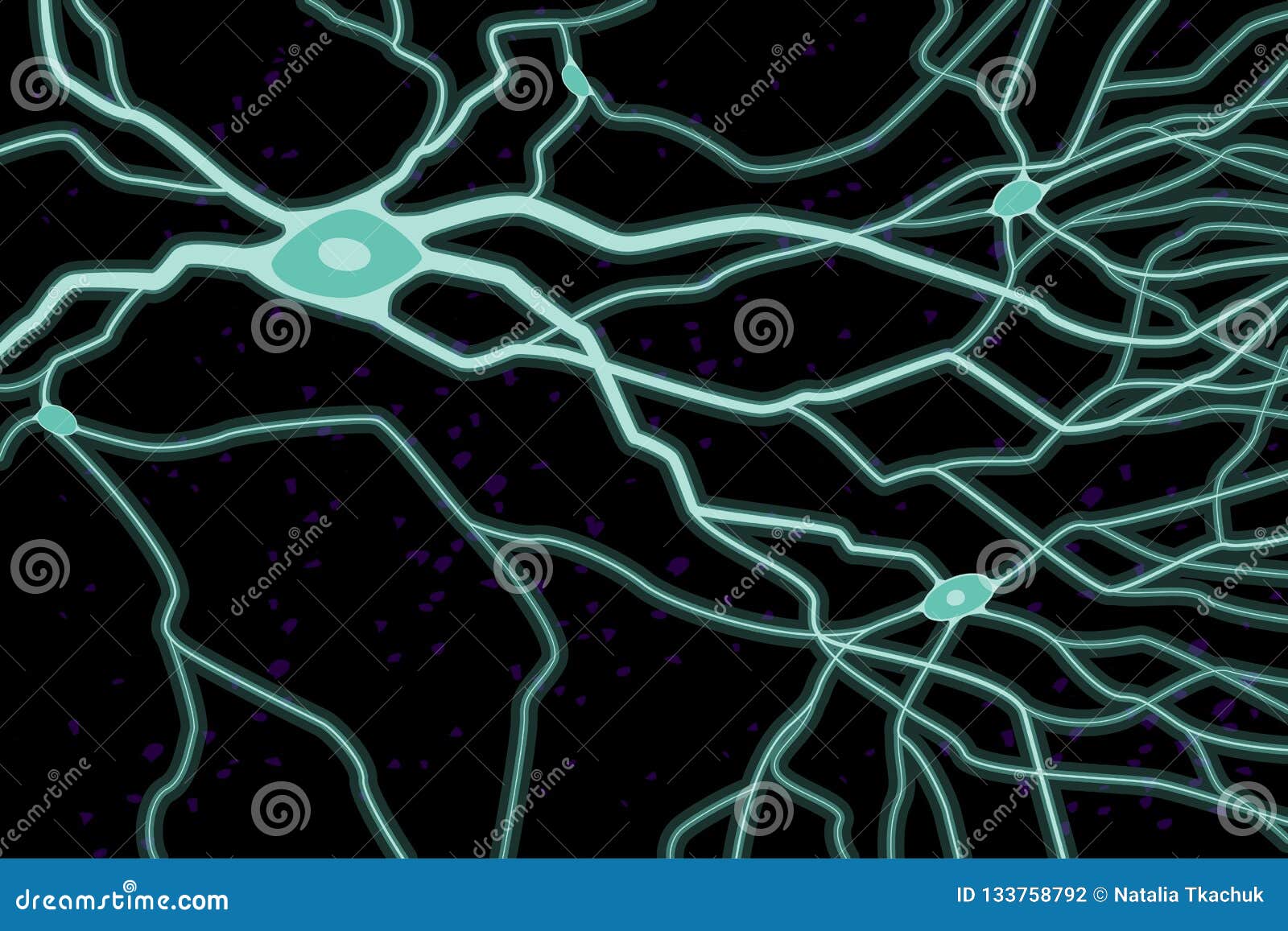 Nerve Celles With Axons, Vector Illustration, Black On Orange ...
