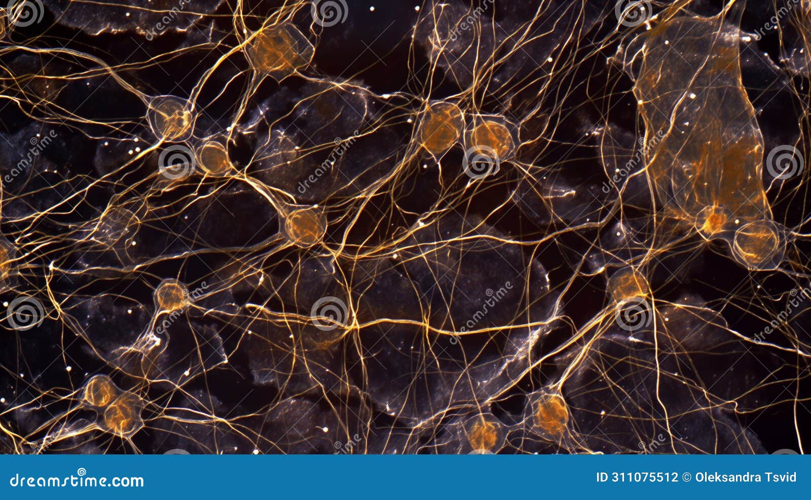 Nerve Cells of the Nervous System Ganglia, Active Neurone Stock Photo ...