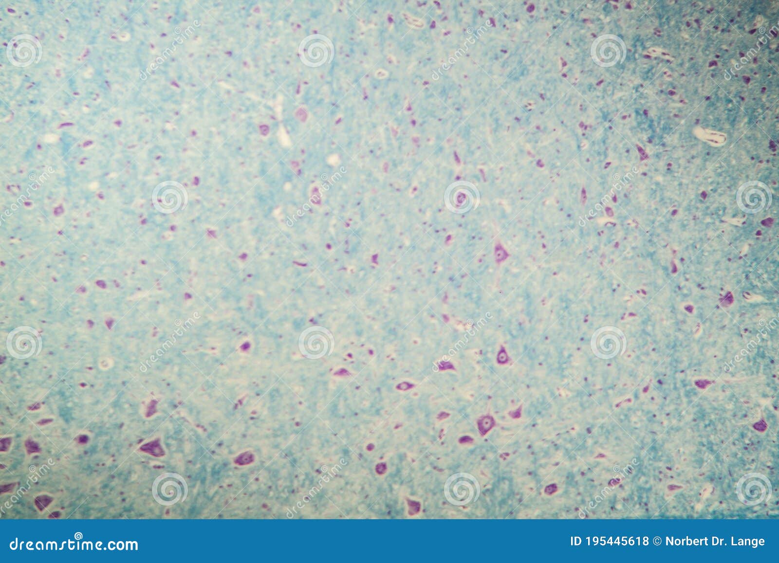 Nerve Cells Under the Microscope Stock Photo - Image of nerve, science ...