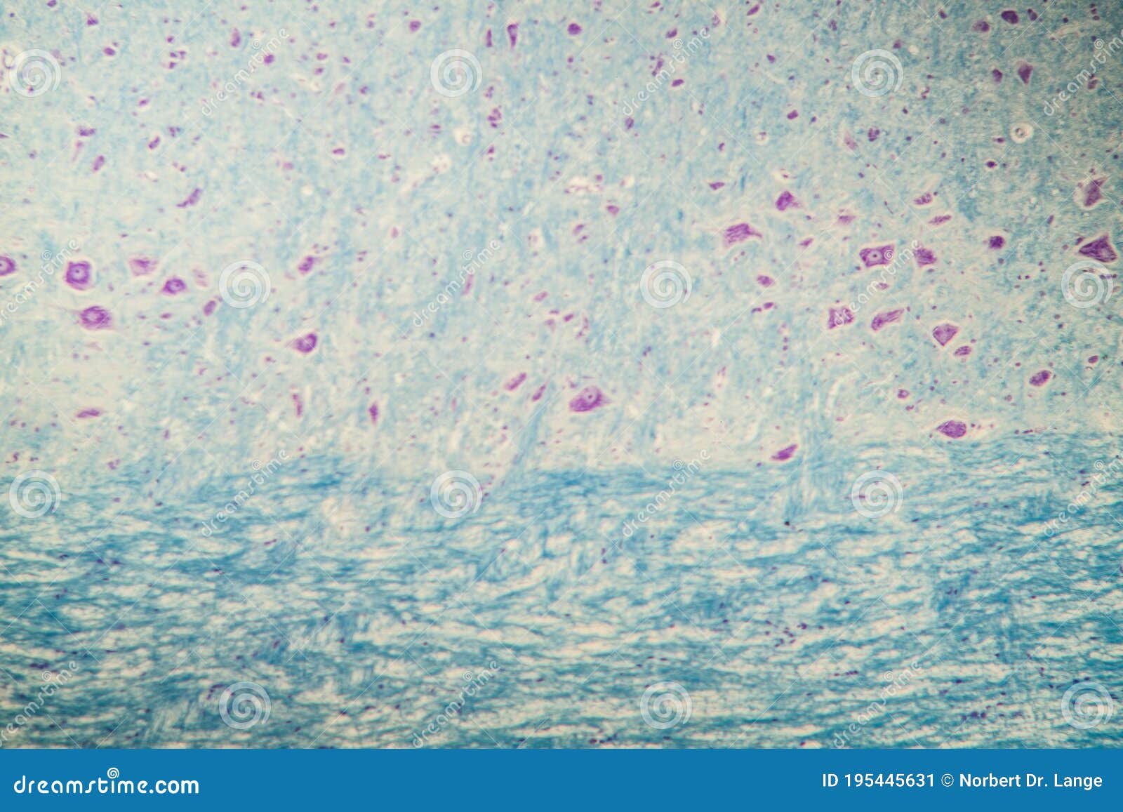 Nerve Cells Under the Microscope Stock Image - Image of 100x, advice ...