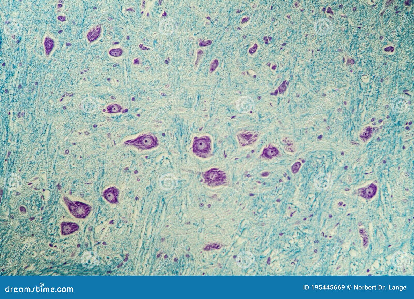 Nerve Cells Under the Microscope Stock Image - Image of advice ...