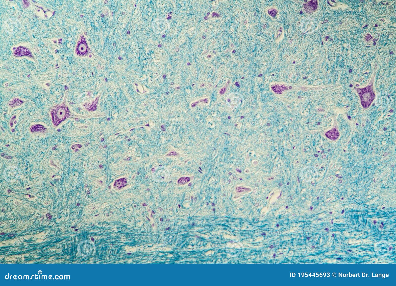 Nerve Cells Under The Microscope Stock Photo | CartoonDealer.com #195445644